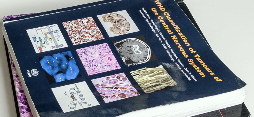 Grading & Classification - Brain Tumor | Johns Hopkins Pathology